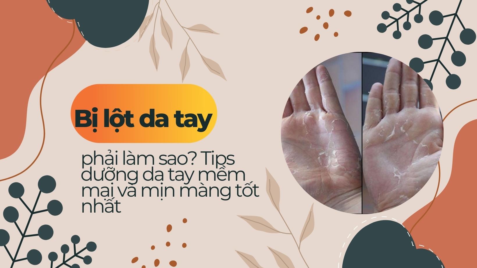 Bị lột da tay phải làm sao? Tips dưỡng da tay mềm mại, hết bong tróc ...
