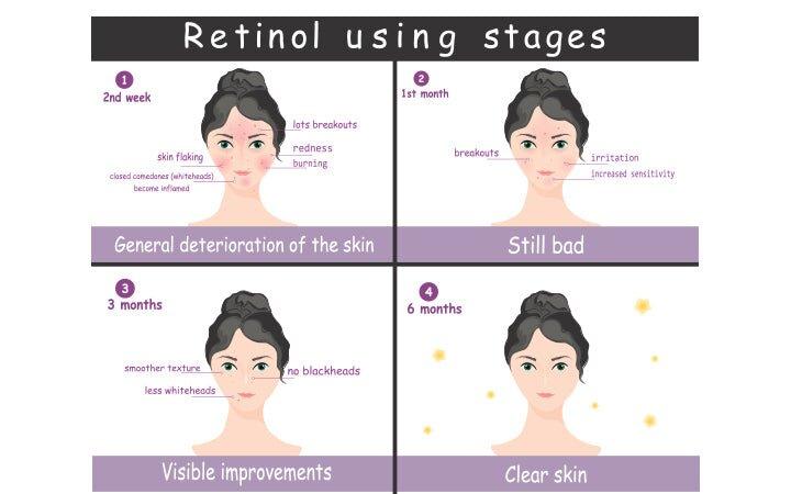 Retinol, Retin-A; Retinoids: Sự khác biệt là gì? - Beaudy.vn