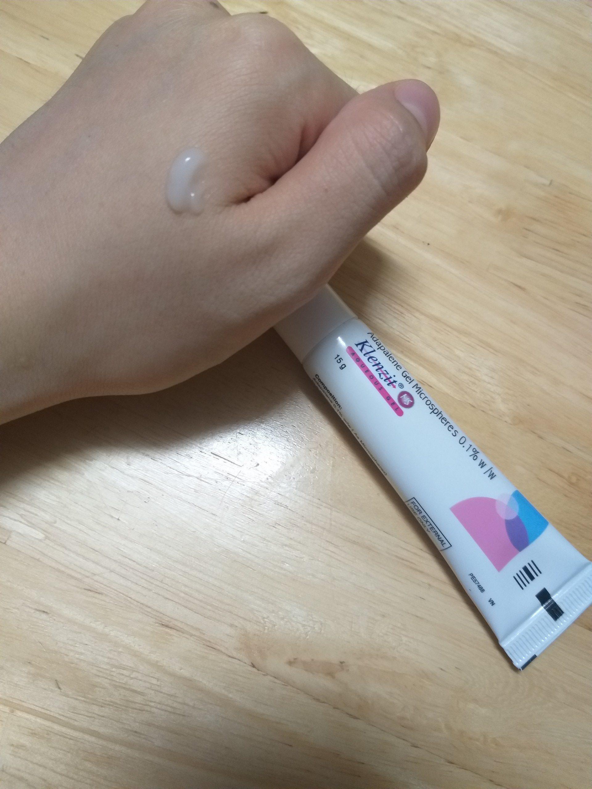 Review gel trị mụn Klenzit MS: đánh bay mụn ẩn hiệu quả - Beaudy.vn