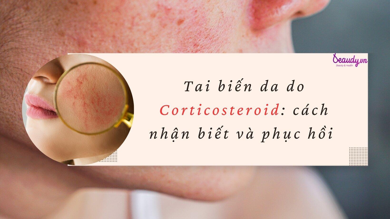4 tai biến da do Corticosteroid thường gặp: cách nhận biết và phục hồi ...