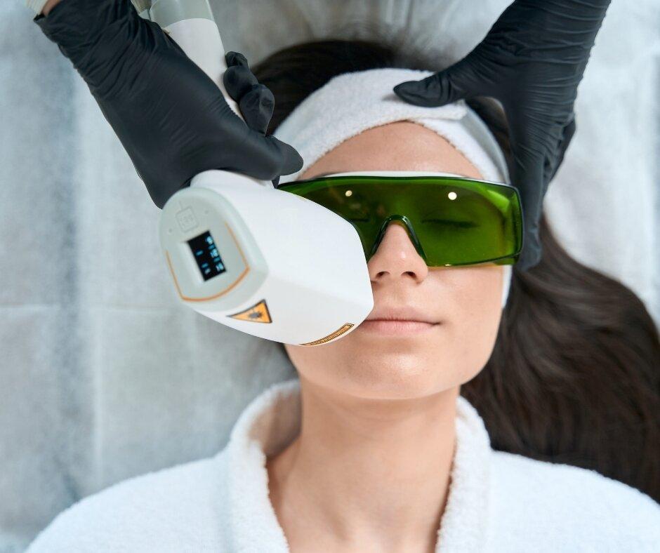 Laser trẻ hóa da là gì: các loại công nghệ laser, quy trình, đối tượng ...