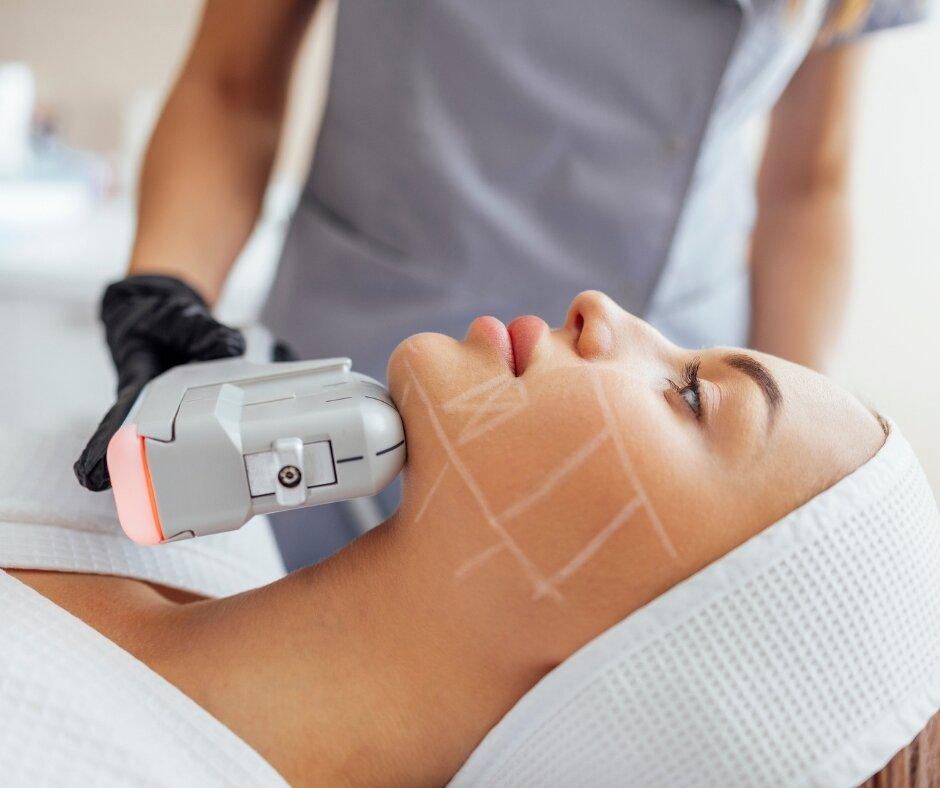 TOP 5 phương pháp xóa nếp nhăn hiện đại và hiệu quả nhất: Laser, RF ...